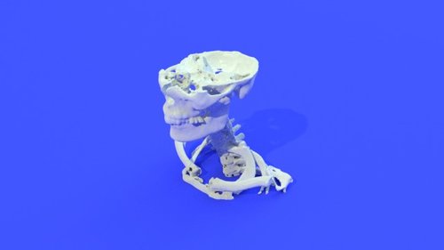 scan Neck - stl file processed - Spine and Pelvis - embodi3D.com
