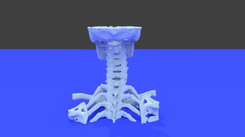 scan Neck - stl file processed - Spine and Pelvis - embodi3D.com