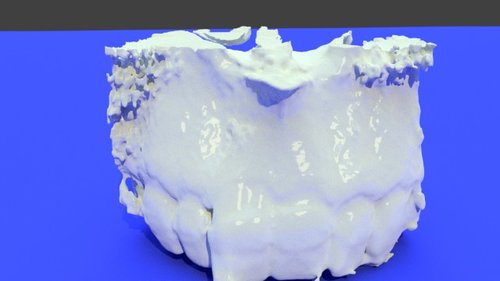 1 3D CBCT Image Set Nov 2019.nrrd - stl file processed - Dental ...