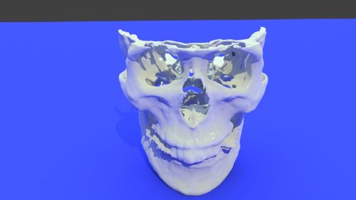 scan jawbone and teeth - stl file processed - Dental, Orthodontic ...