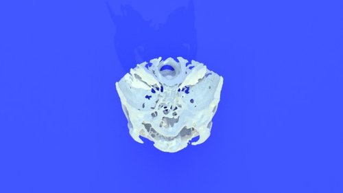 scan jawbone and teeth - stl file processed - Dental, Orthodontic ...