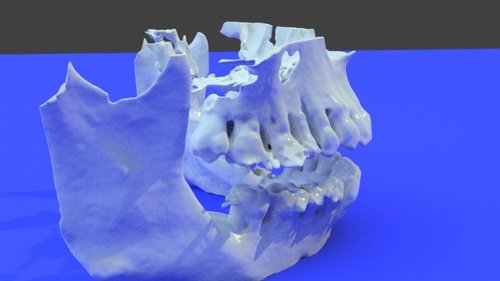 Mandibula - stl file processed - Dental, Orthodontic, Maxillofacial ...