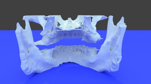 Mandibula - stl file processed - Dental, Orthodontic, Maxillofacial ...