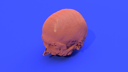 CT Scan - stl file processed - Head and neck muscles - embodi3D.com
