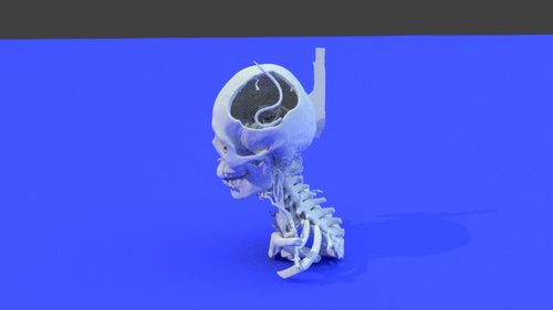 skull - stl file processed - Skull and Face - embodi3D.com