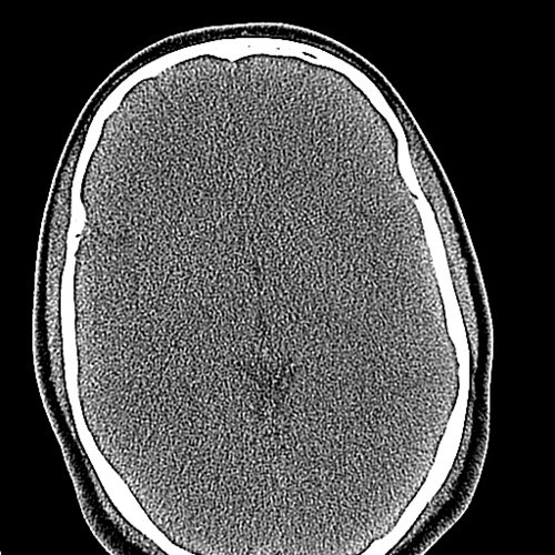 suni - Skull, Head, and Neck CTs - embodi3D.com