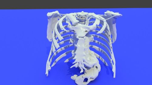 Dad's ClearRead CT Vessel Suppress - stl file processed - Thorax and ...