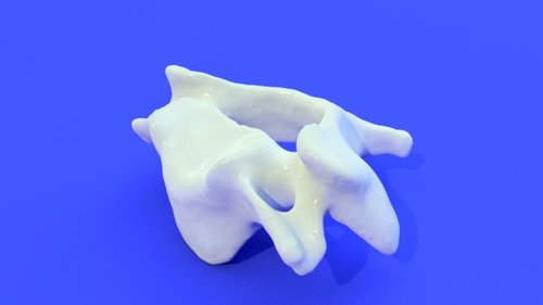 Cervical Spine C1-C5 - Spine and Pelvis - embodi3D.com