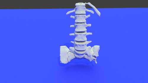 CT Lumbar - stl file processed - democratiz3D® Processing - embodi3D.com