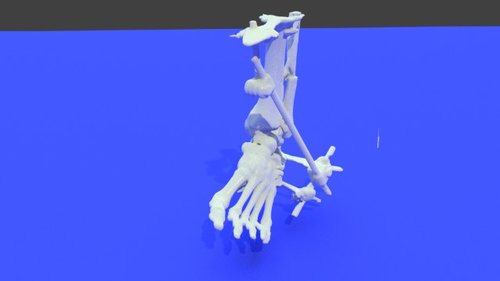 leg - stl file processed - Extremity, Lower (Leg) - embodi3D.com