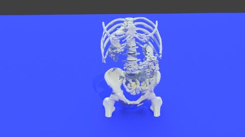 Test CT Pelvis - stl file processed - Spine and Pelvis - embodi3D.com