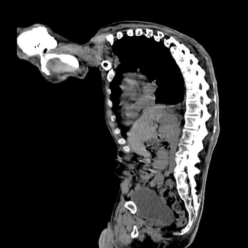 processed 1 - Whole Body CTs - embodi3D.com
