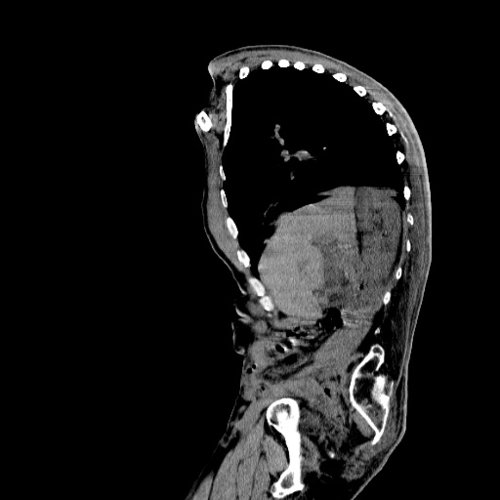 processed 1 - Whole Body CTs - embodi3D.com