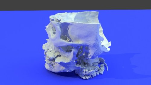 max fax surgery - stl file processed - Skull and Face - embodi3D.com