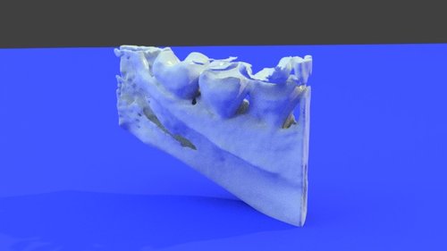 Teeth - stl file processed - Dental, Orthodontic, Maxillofacial ...