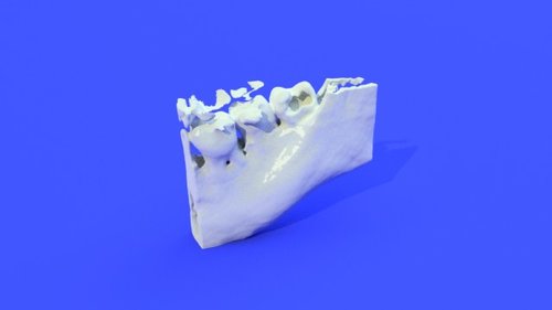 Teeth - stl file processed - Dental, Orthodontic, Maxillofacial ...
