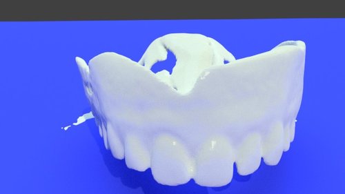 10 set 6 - stl file processed - Dental, Orthodontic, Maxillofacial ...