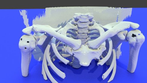 ribs - stl file processed - Thorax and Ribs - embodi3D.com