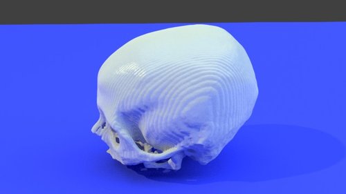 Cranial ct - stl file processed - Skull and Face - embodi3D.com