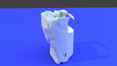 Dental CBCT - stl file processed - Dental, Orthodontic, Maxillofacial ...