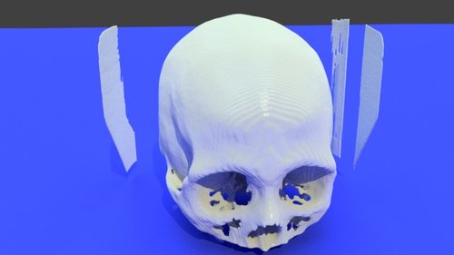 Cranial ct - stl file processed - Skull and Face - embodi3D.com