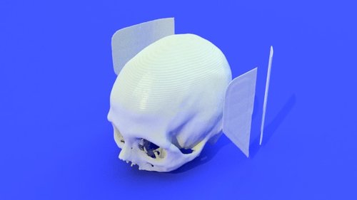 Cranial ct - stl file processed - Skull and Face - embodi3D.com