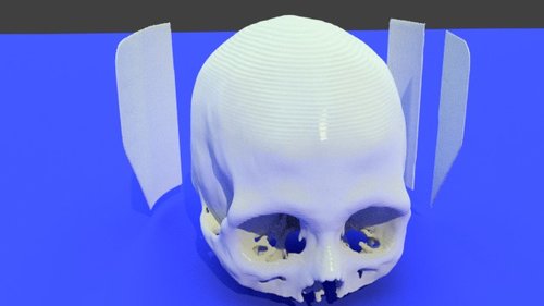 Cranial ct - stl file processed - Skull and Face - embodi3D.com