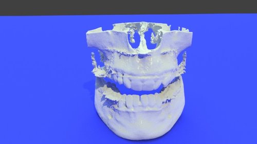 test - stl file processed - Dental, Orthodontic, Maxillofacial ...