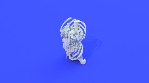 ct abdominal - stl file processed - Other organs - embodi3D.com