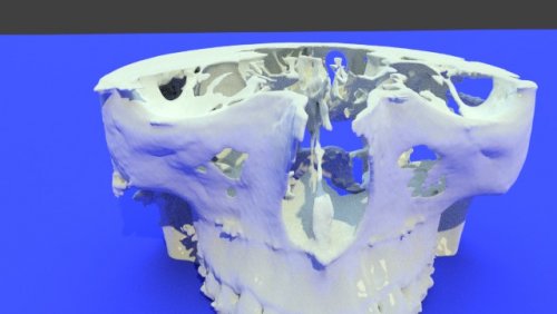 test - stl file processed - Dental, Orthodontic, Maxillofacial ...
