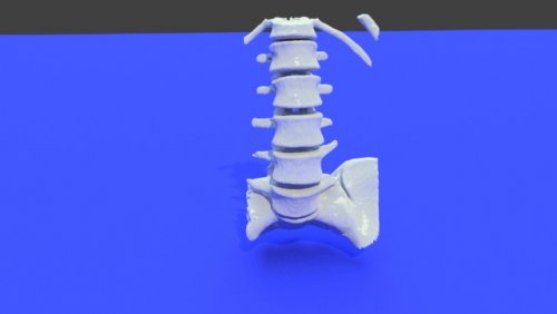 my back - stl file processed - Spine and Pelvis - embodi3D.com