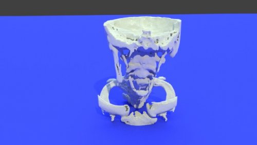 spine - stl file processed - democratiz3D® Processing - embodi3D.com