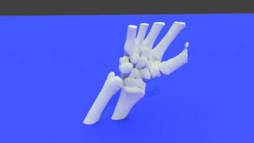 tesy4 - stl file processed - Extremity, Upper (Arm) - embodi3D.com
