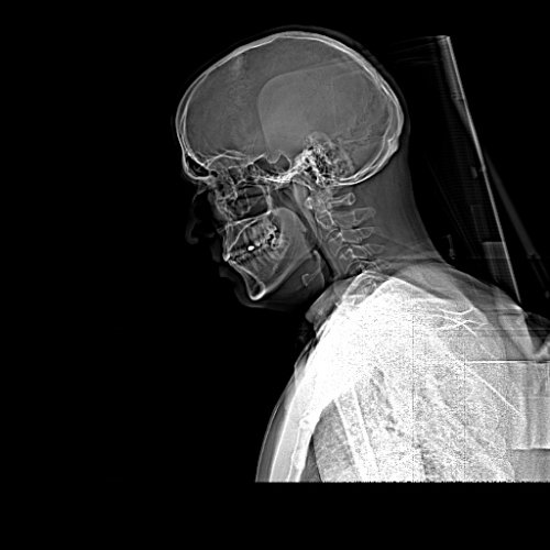 Tim Brain Scan - Skull, Head, and Neck CTs - embodi3D.com