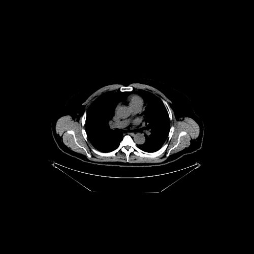 full body bone CT - Whole Body CTs - embodi3D.com