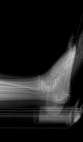 sid - Lower Extremity CTs - embodi3D.com