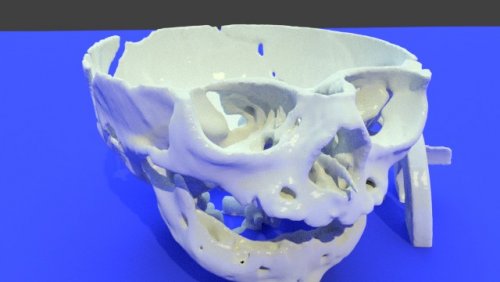TEST3 - stl file processed - democratiz3D® Processing - embodi3D.com