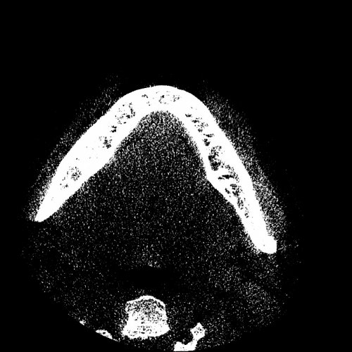 0 Both Arches NRRD file - democratiz3D® Processing - embodi3D.com