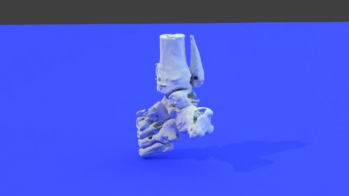 foot - stl file processed - Extremity, Lower (Leg) - embodi3D.com