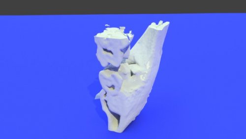 DICOM - stl file processed - Dental, Orthodontic, Maxillofacial ...