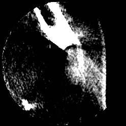 DICOM - Dental, Orthodontic, Maxillofacial CTs - embodi3D.com