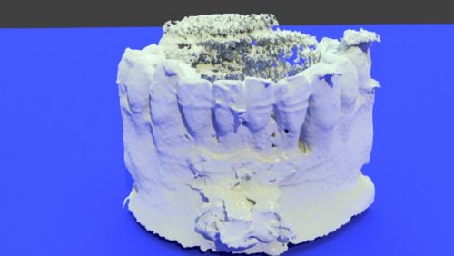 Tooth Pulp Resorption - stl file processed - Dental, Orthodontic ...