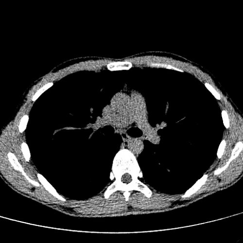 Thorax bones - Thorax CTs - embodi3D.com