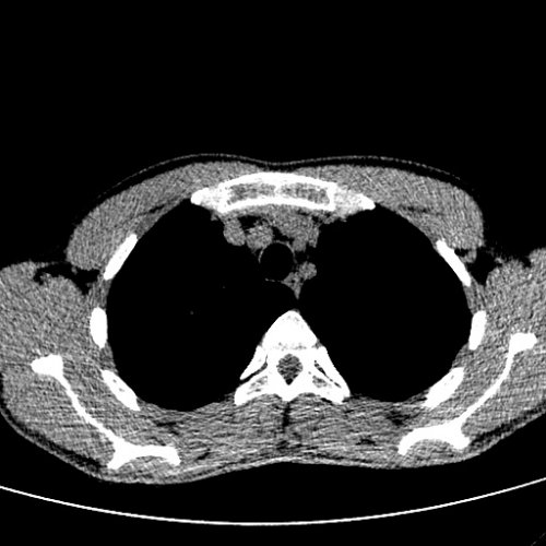 Thorax bones - Thorax CTs - embodi3D.com