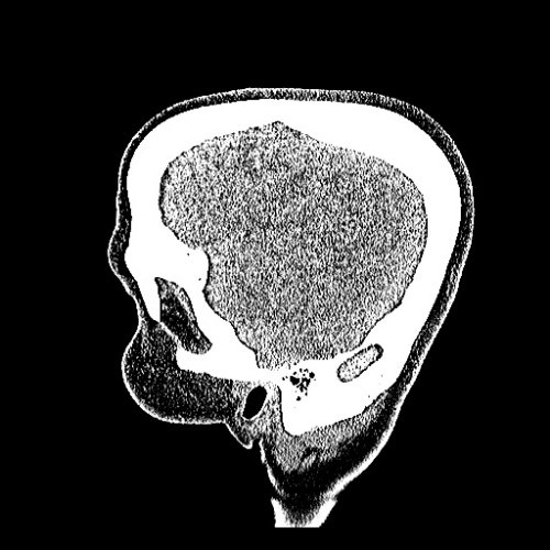 Muscle L - democratiz3D® Processing - embodi3D.com