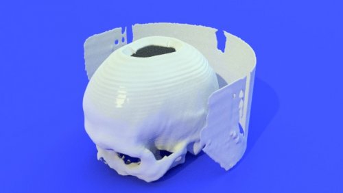 test CT skull file - stl file processed - Skull and Face - embodi3D.com