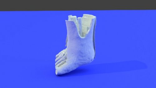 broken enkle - stl file processed - Extremity, Lower (Leg) Muscles ...