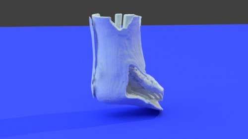 broken enkle - stl file processed - Extremity, Lower (Leg) Muscles ...