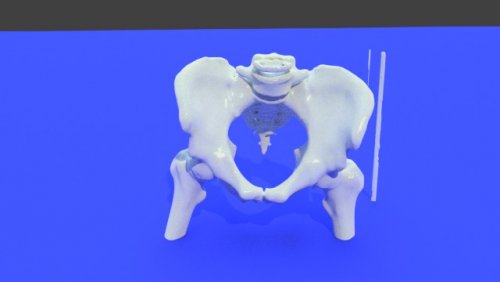 Pelvis1 - stl file processed - Spine and Pelvis - embodi3D.com