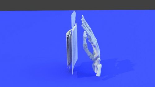 Sample 3D hand model - stl file processed - Extremity, Upper (Arm ...